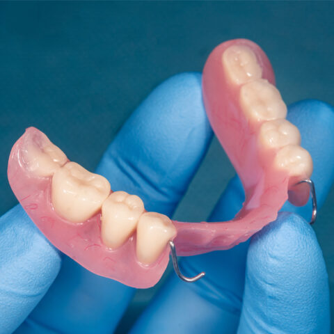 Acrylic Dentures Melbourne | Dentures 4 You